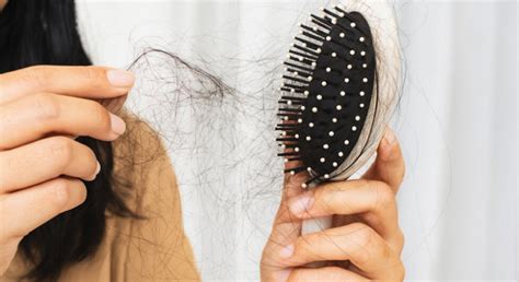 Vitamin A Hair Loss Why Too Much Can Cause Hair Loss