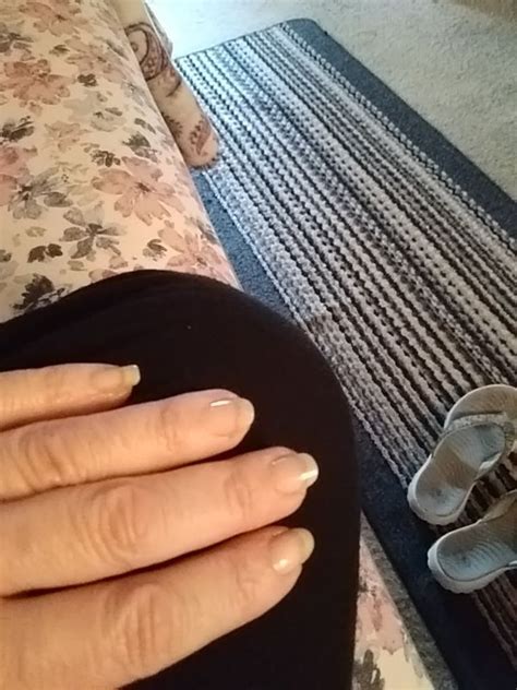 First Aid Kiss Nail Strengthener Stop Peeling Cracking Weak Nails