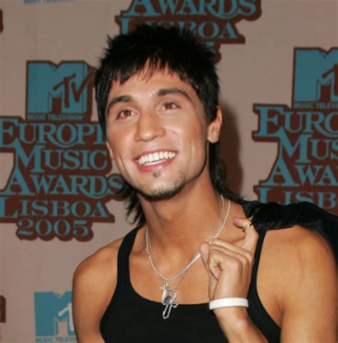 🧑‍🎤 Los Dientes De Dima Bilan Antes Y Después