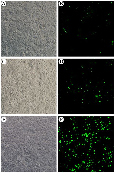 Effect Of Afp Silencing On Apoptosis Of Huh 7 Cells Cells Were