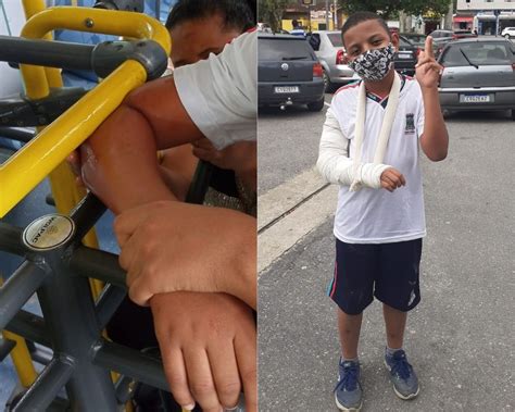 Menino de 11 anos torce o braço ao prendê lo em catraca de ônibus em