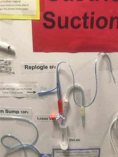 What Is A Replogle Tube At Patricia Nobles Blog