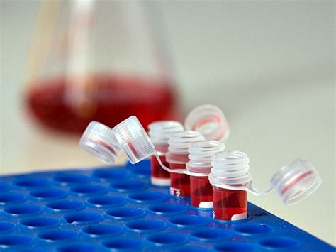 Плевен За Плевен 28 юли Световен ден за борба с хепатита