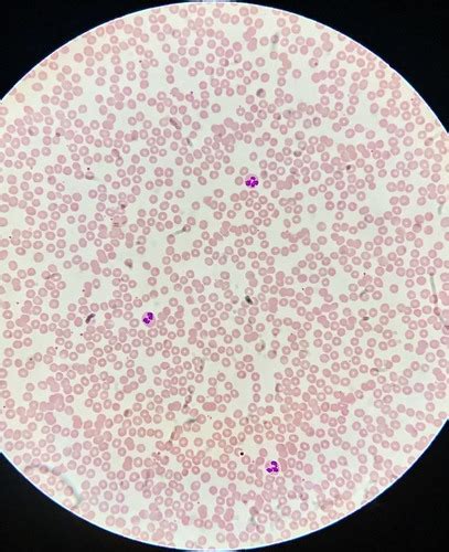 Bio 210 Lab 2 Exam Flashcards Quizlet