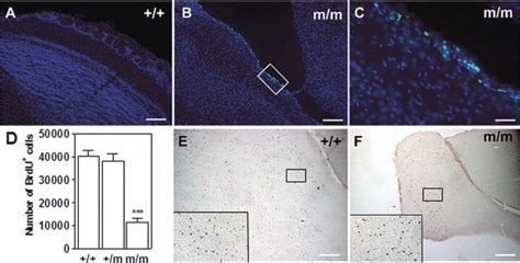 Tunel Staining And Cell Proliferation In The Ob A Ob Showing
