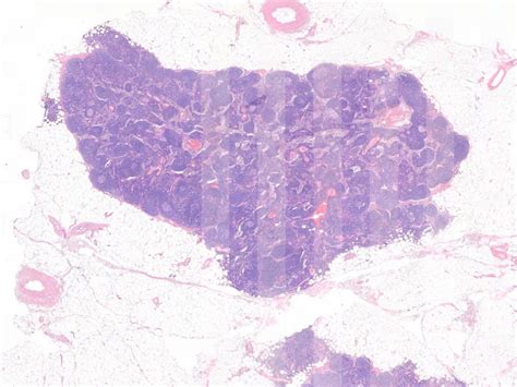 Automated Quality Control For Digital Pathology Slides