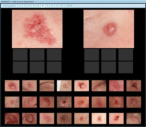 2 Web Interface Developed To Collect Similarity Assessment Data Download Scientific Diagram