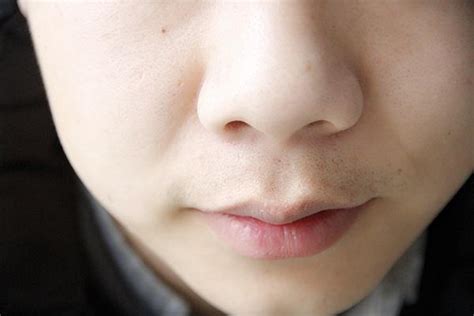 鼻子两侧挤出的白色物体，是螨虫的分泌物吗？该如何清除？东方养生频道东方养生