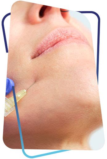 Botulinum Toksin Aky Health