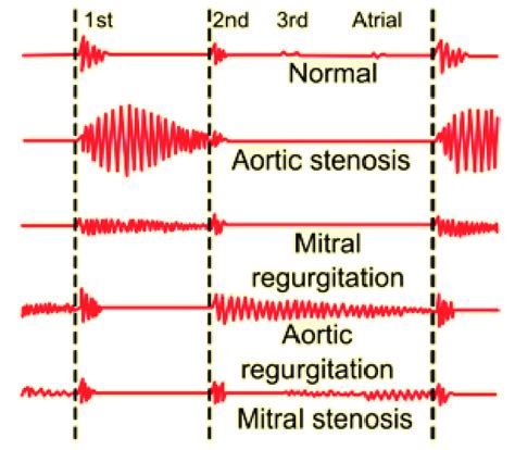 Cardiac Cycle And Heart Sounds Pharmaacademias