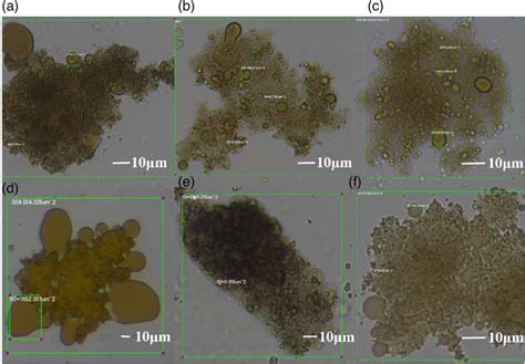 Light Microscope Image Of Flocs At 400 Times Magnification A