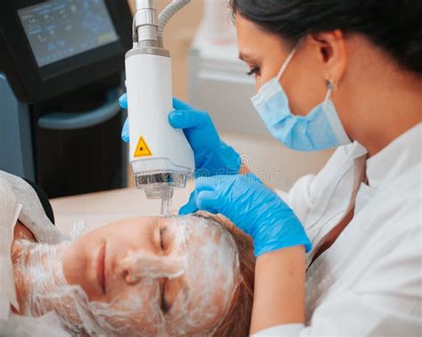 Laser Removal Of Scars And Scars On The Skin Stock Image Image Of