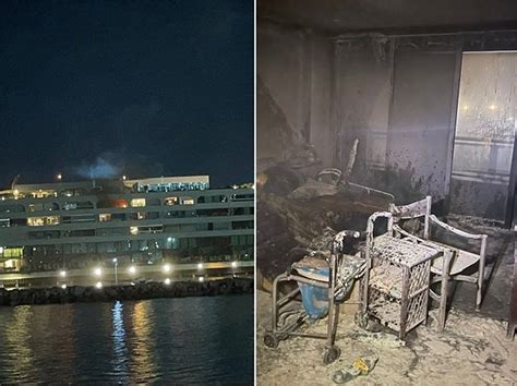 Morre idoso que teve 40 do corpo queimado em incêndio no Porto Trapiche