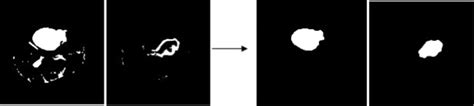 Morphological Operations On Segmented Image Download Scientific Diagram