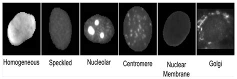feature importance for human epithelial hep 2 cell image classification