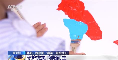 33年公益行动 他们让48836名唇腭裂患儿绽放微笑——人民政协网