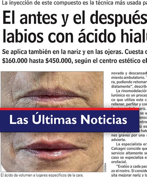 Reportaje En Diario Las Últimas Noticias Dra Sofía Calcagni