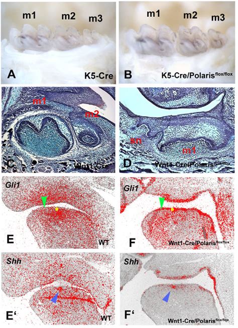 Figure 3 From Primary Cilia Regulate Shh Activity In The Control Of Molar Tooth Number