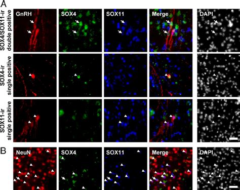 Sox C Factors Are Enriched In Adult Hypothalamic Gnrh Neurons Immuno