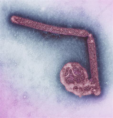 Avian Influenza A H5n1 Stock Image C0129727 Science Photo Library