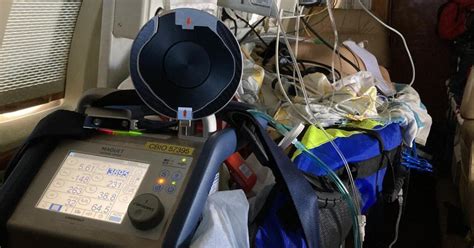 Solenn Coz On Linkedin Case Study Transfer Without Ecmo Of A Patient