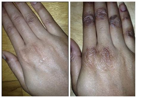 Diy How To Fade Your Dark Knuckles Naturally