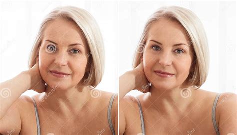 Middle Age Close Up Woman Happy Face Before After Cosmetic Procedures