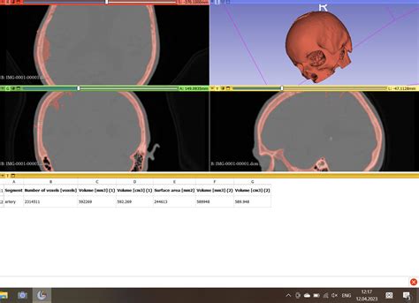 Where Is Hu At Segment Statistics Module Support 3d Slicer Community
