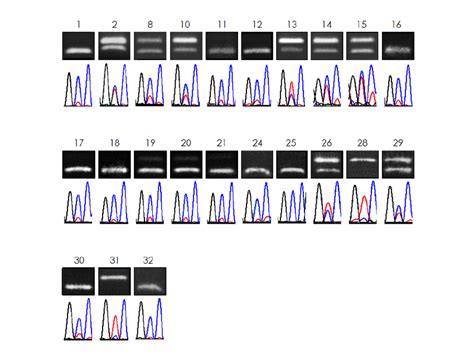 Pcr Rflp Analysis Using Apai Polymorphism And Sequencing For