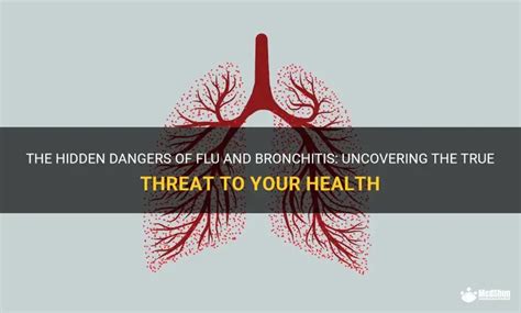The Hidden Dangers Of Flu And Bronchitis Uncovering The True Threat To Your Health Medshun