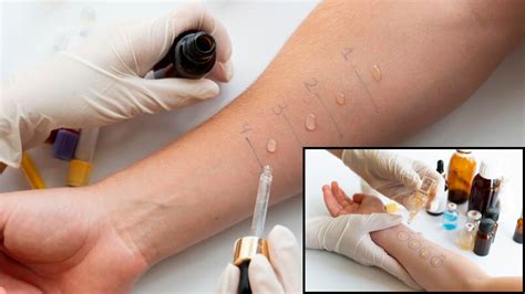 Best Drug Allergy Testing In Kolkata Asthma And Allergy
