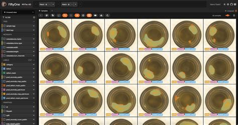 Anomaly Detection With Fiftyone And Anomalib — Fiftyone 180 Documentation