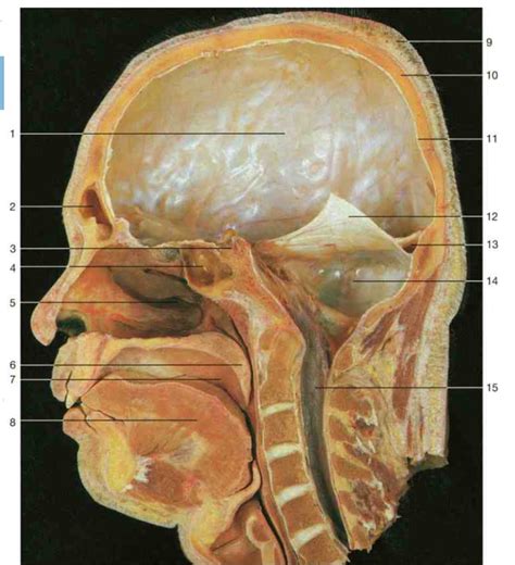 Meninges Dura Mater Diagram Quizlet