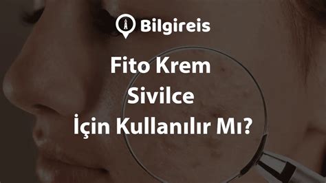Fito Krem Sivilce İçin Kullanılır Mı