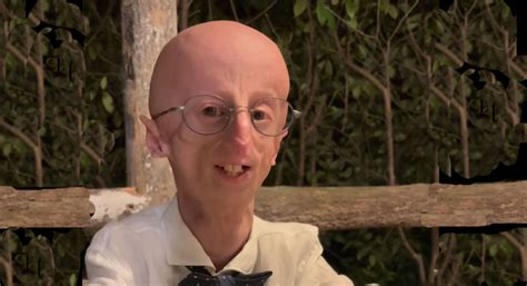 E Morto Sammy Basso Aveva 28 Anni Ed Era Affetto Da Progeria