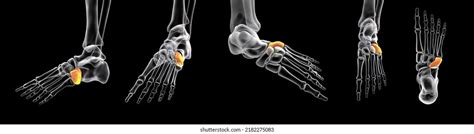 Pie Hueso Anatomía Cuboides Fx