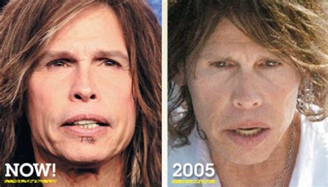 Celebrity Boob Jobs Steven Tyler Plastic Surgery Before And After