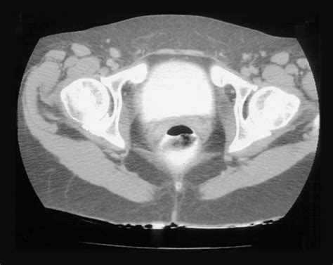 Female Pelvic Ct 18 Diagram Quizlet