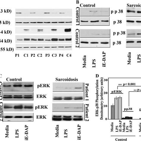 Effect Of Nucleotide Binding Oligomerization Domain 1 Nod1 And
