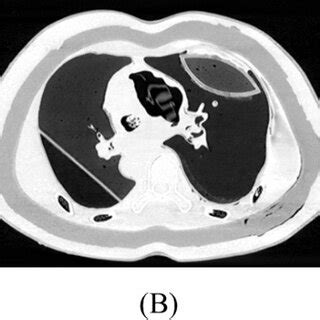 Various CT Image Settings Of The Phantoms A CT Volume Rendering Download Scientific Diagram