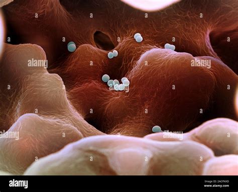Mrsa Bacteria Coloured Scanning Electron Micrograph Sem Methicillin