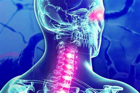 Esclerosis múltiple diagnóstico temprano reduce en progresión de enfermedad Noticias