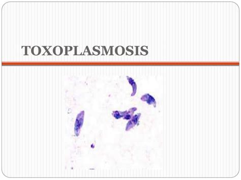 Torch Infection In Neonate Newborn Ppt