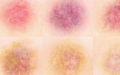 12 Bruise Color Chart MillarHarper