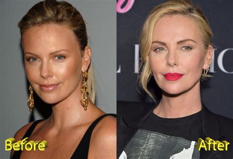Charlize Theron Plastic Surgery Before And After Pict