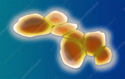 Saprophytic Bacteria