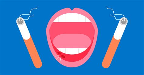 Does Smoking Cause Canker Sores Smartmouth