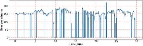 A Sample Fhr Signal With A Lot Of Missing Values Download Scientific Diagram