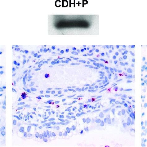 Pulmonary Mcp 1 Expression And Monocytesmacrophages After Prenatal