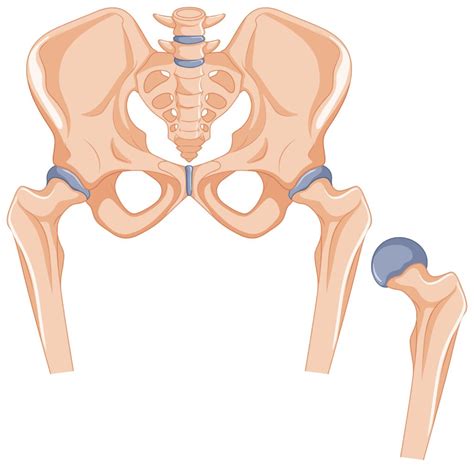 Hip Replacement Surgery Everything You Need To Know Dr Wang Lushun